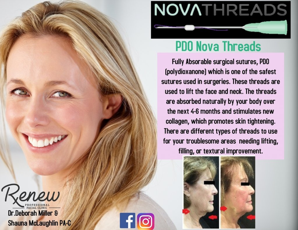 PDO Thread POST - Medical Spa Houston & Webster, TX | M Spa Face and Body